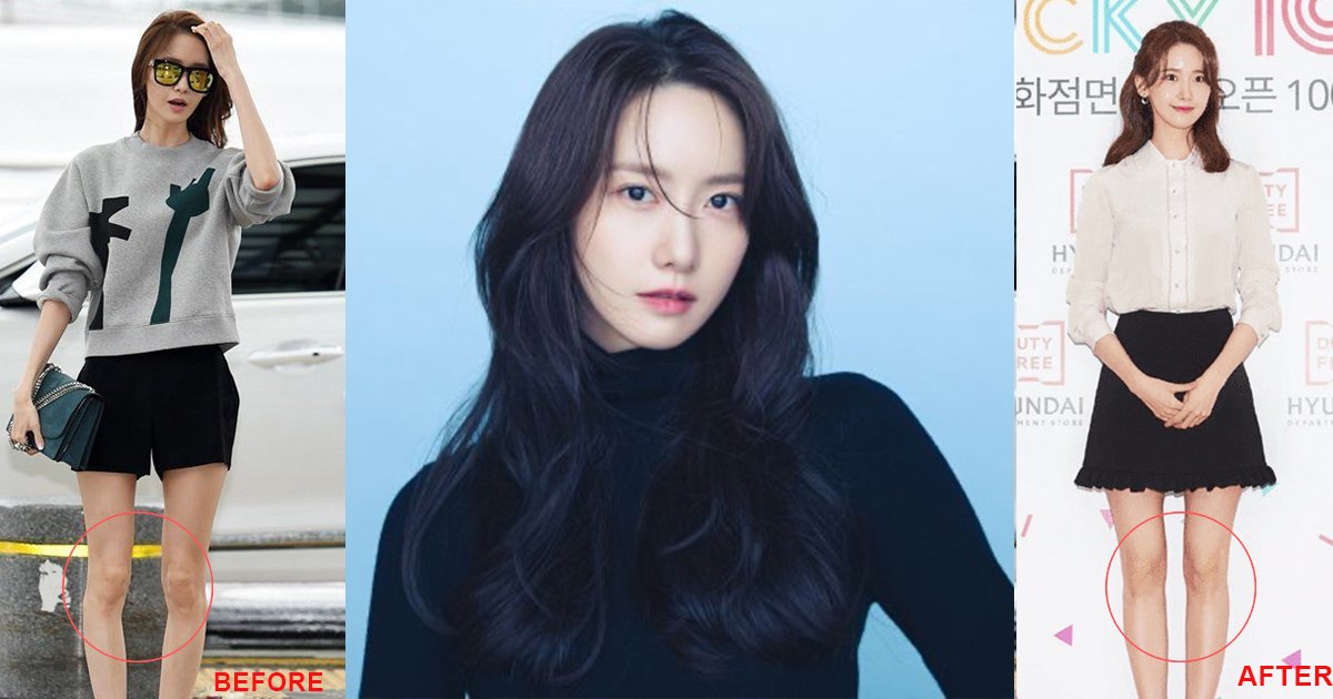 Yoona (SNSD) khắc phục được khuyết điểm chân vòng kiềng nhờ tập pilates
